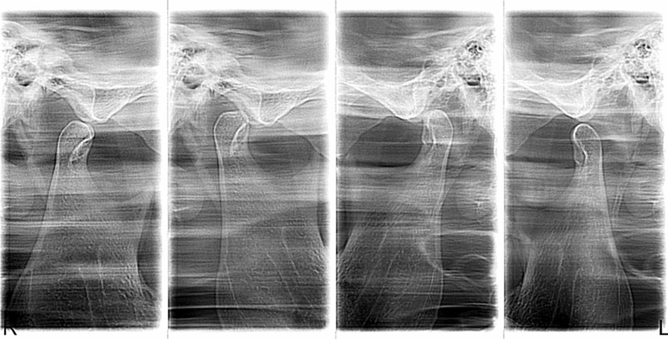 Röntgen | C Dental Centar